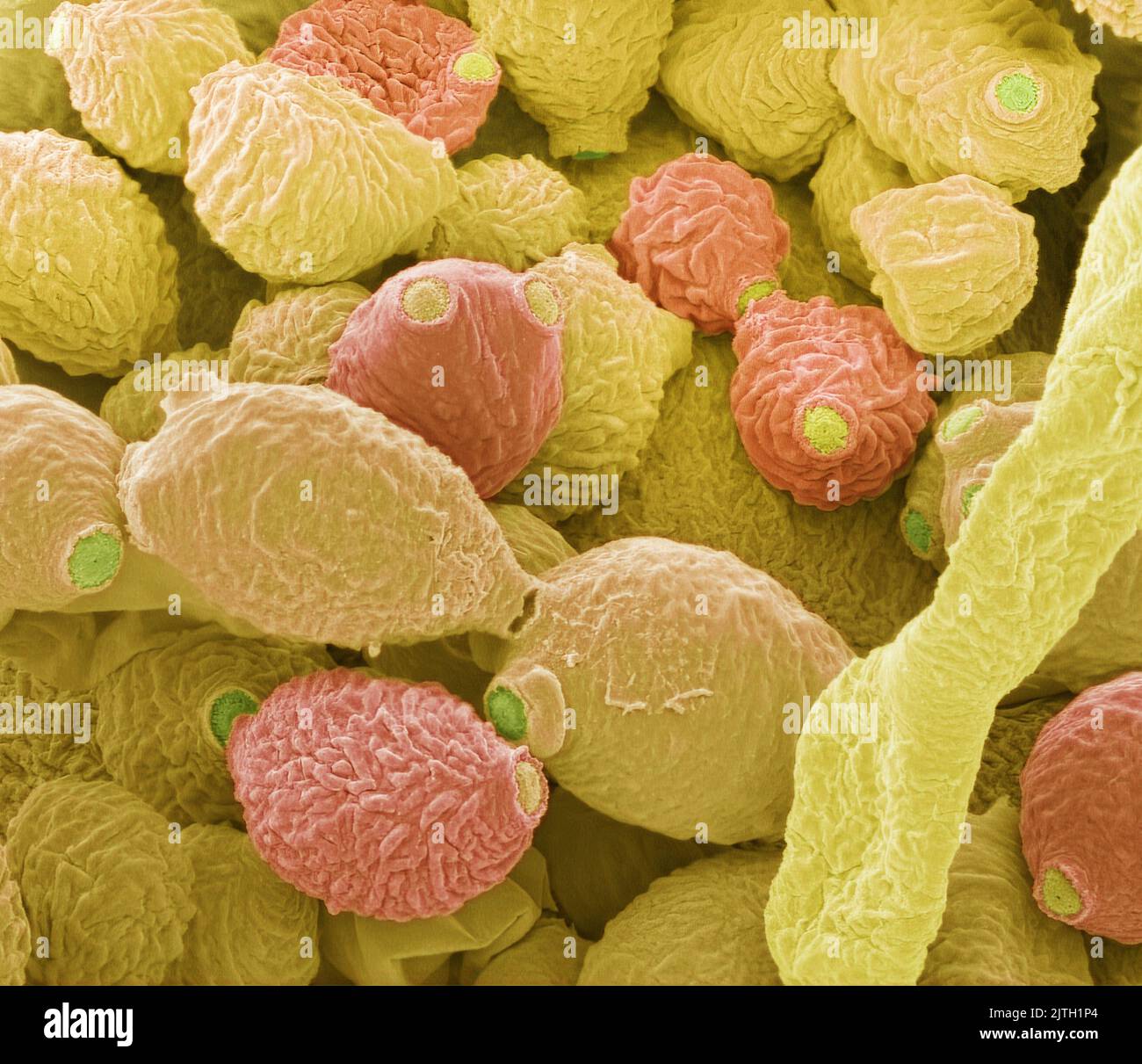 Oral fungi, SEM Stock Photo - Alamy