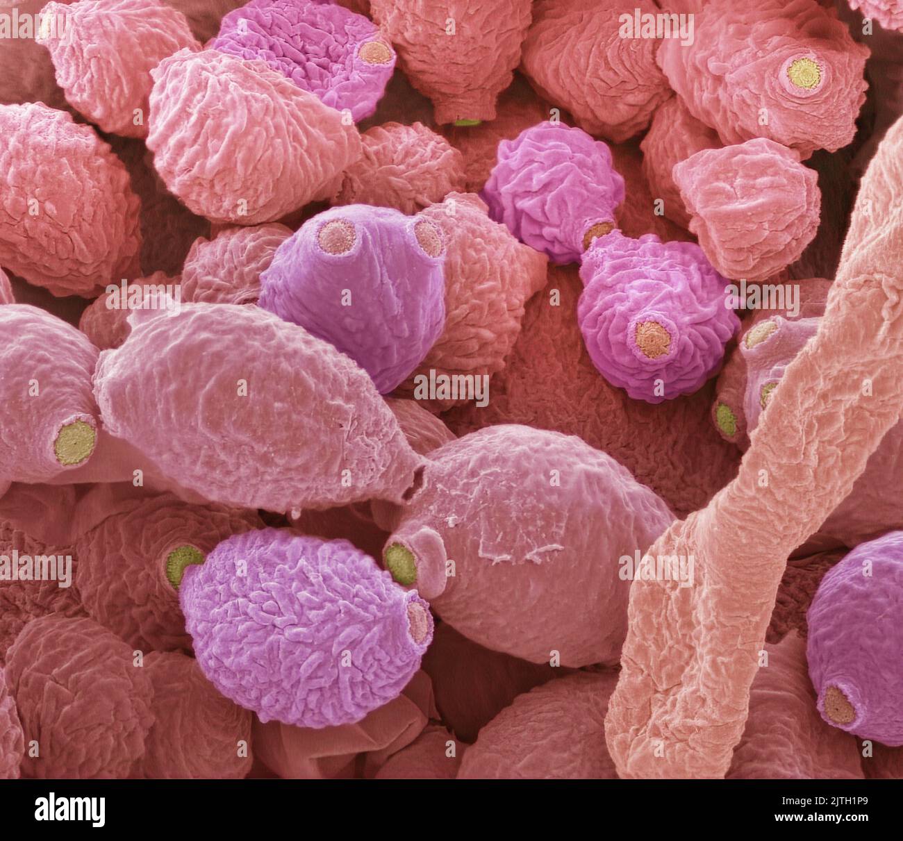 Oral fungi, SEM Stock Photo - Alamy