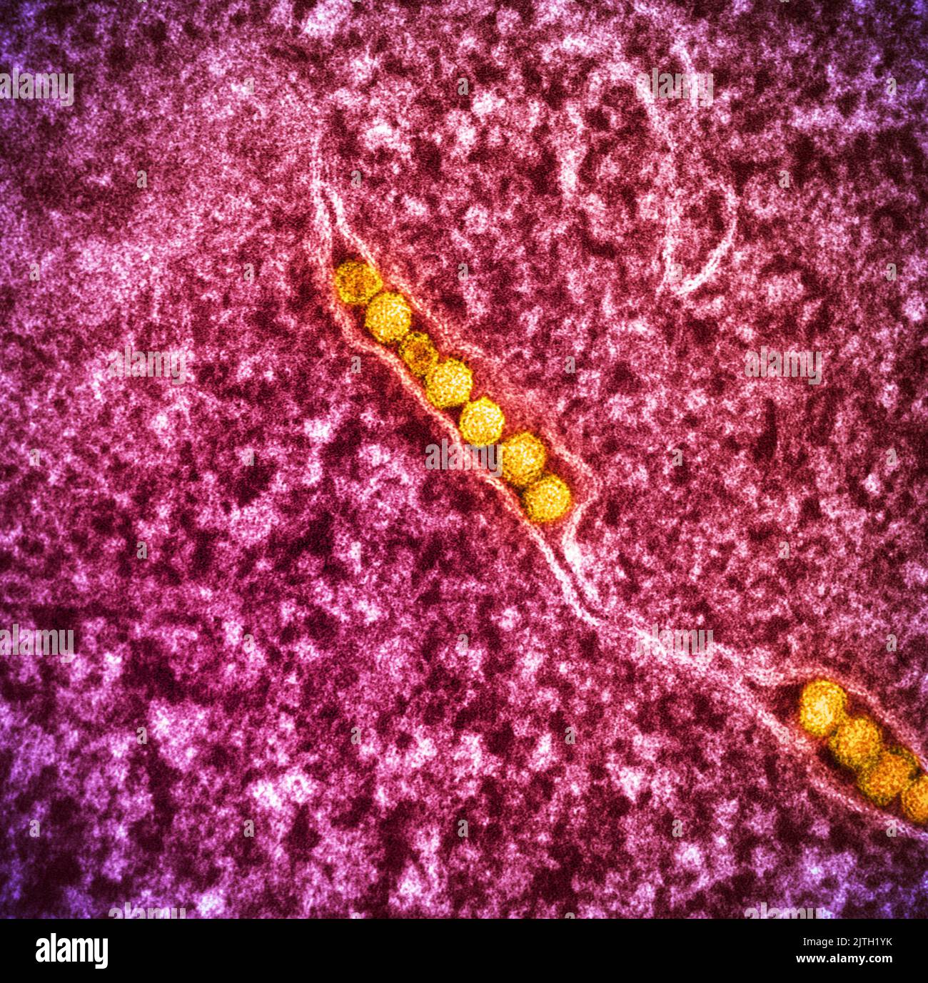 West Nile virus particles, TEM Stock Photo - Alamy