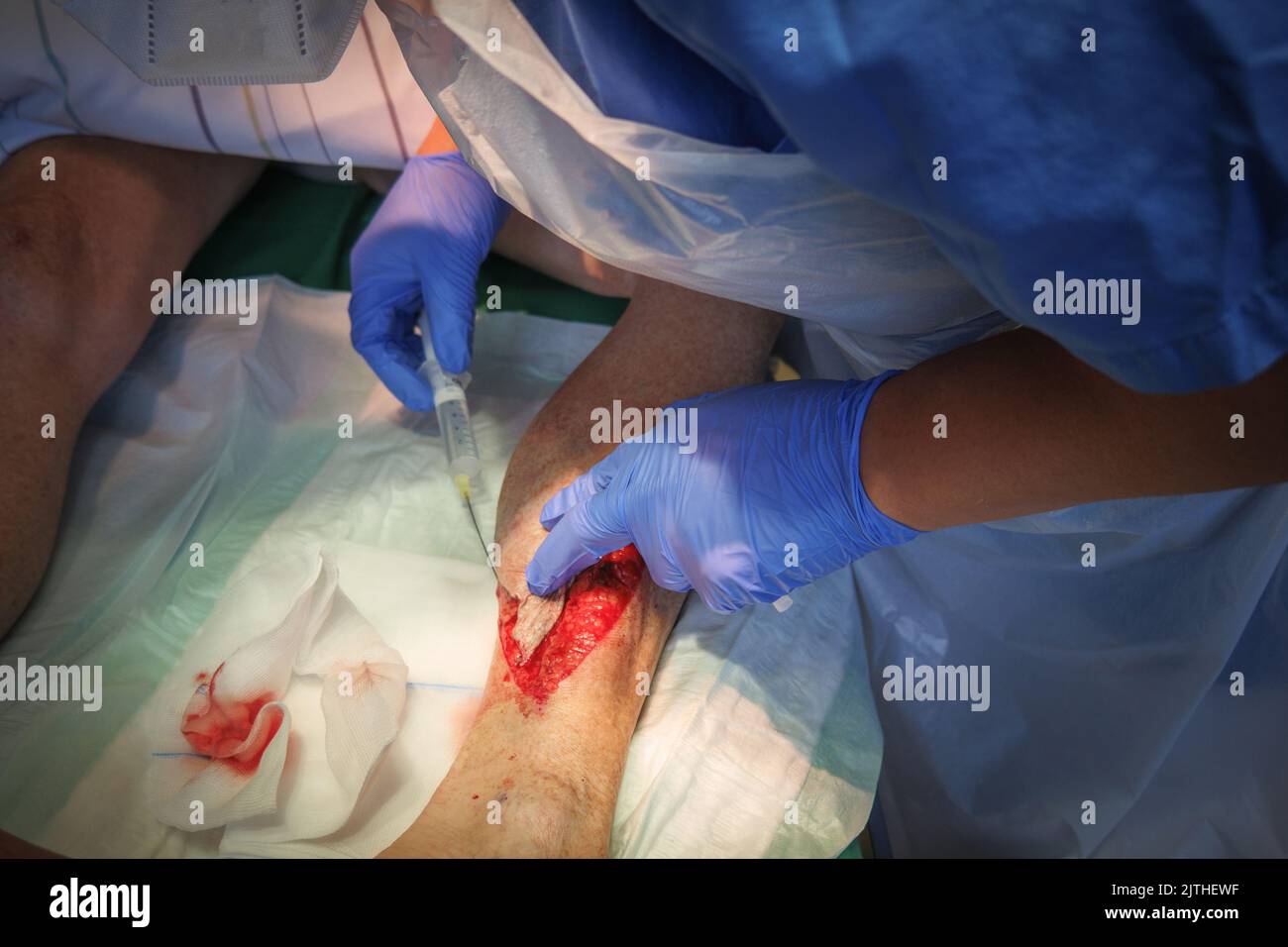 Laceration hi-res stock photography and images - Alamy