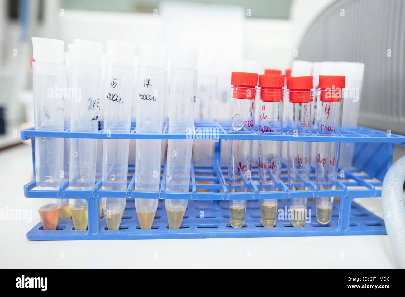 Medical test tubes with urine tests in a biochemical laboratory Stock ...