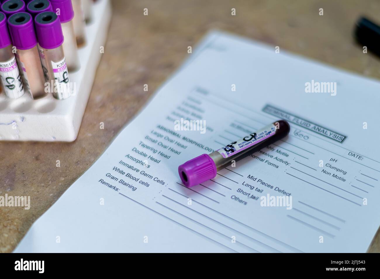 Blood sample in test tube. Medical concept Stock Photo - Alamy Blood sample in test tube. Medical concept Stock Photo - Alamy