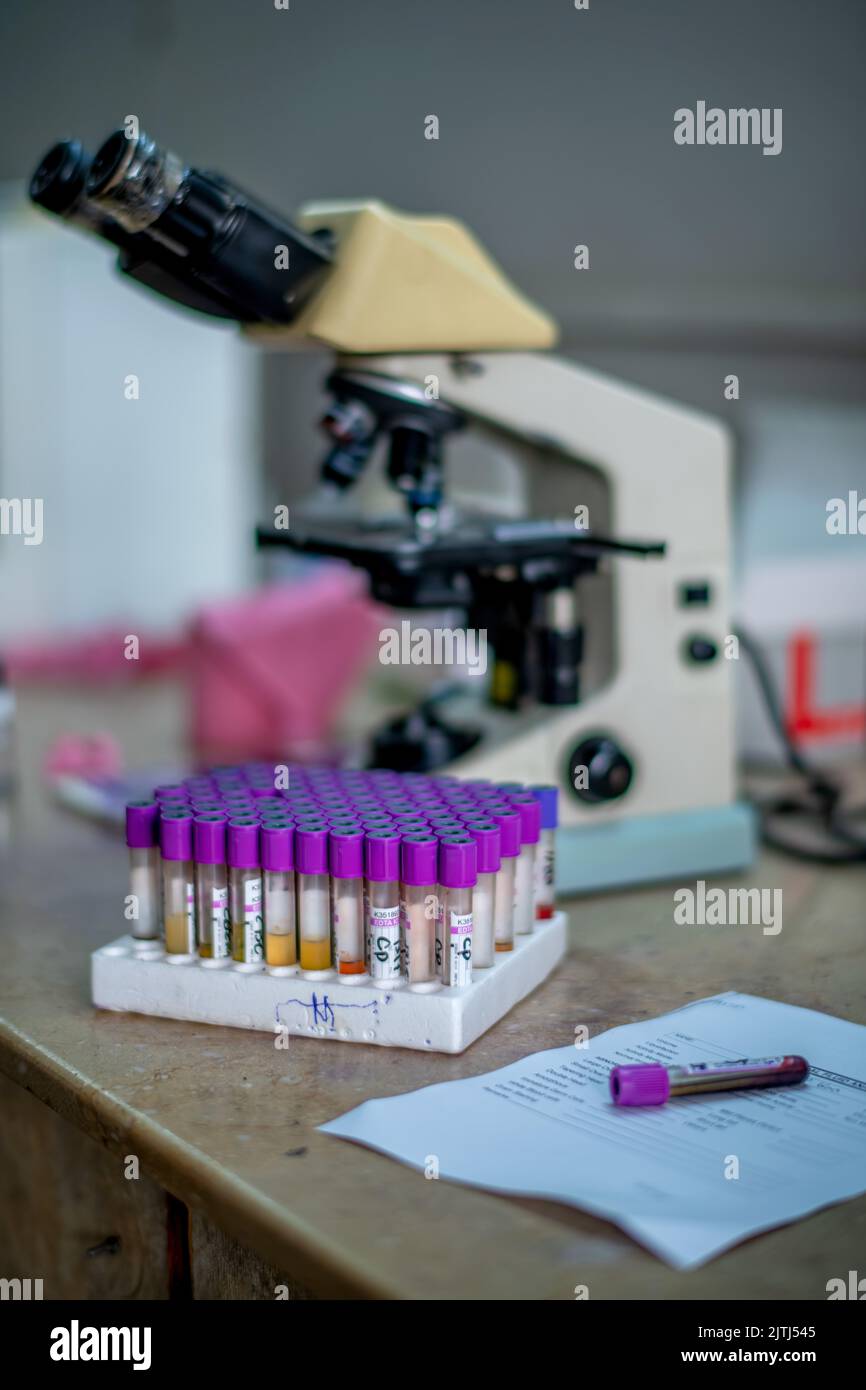 Blood sample in test tube. Medical concept Stock Photo - Alamy