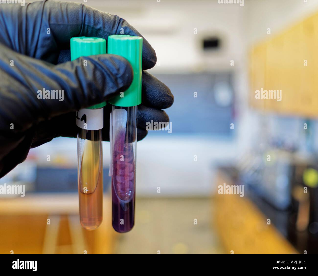 Two tubes of lysine iron agar, one positive for Salmonella. Classic ...
