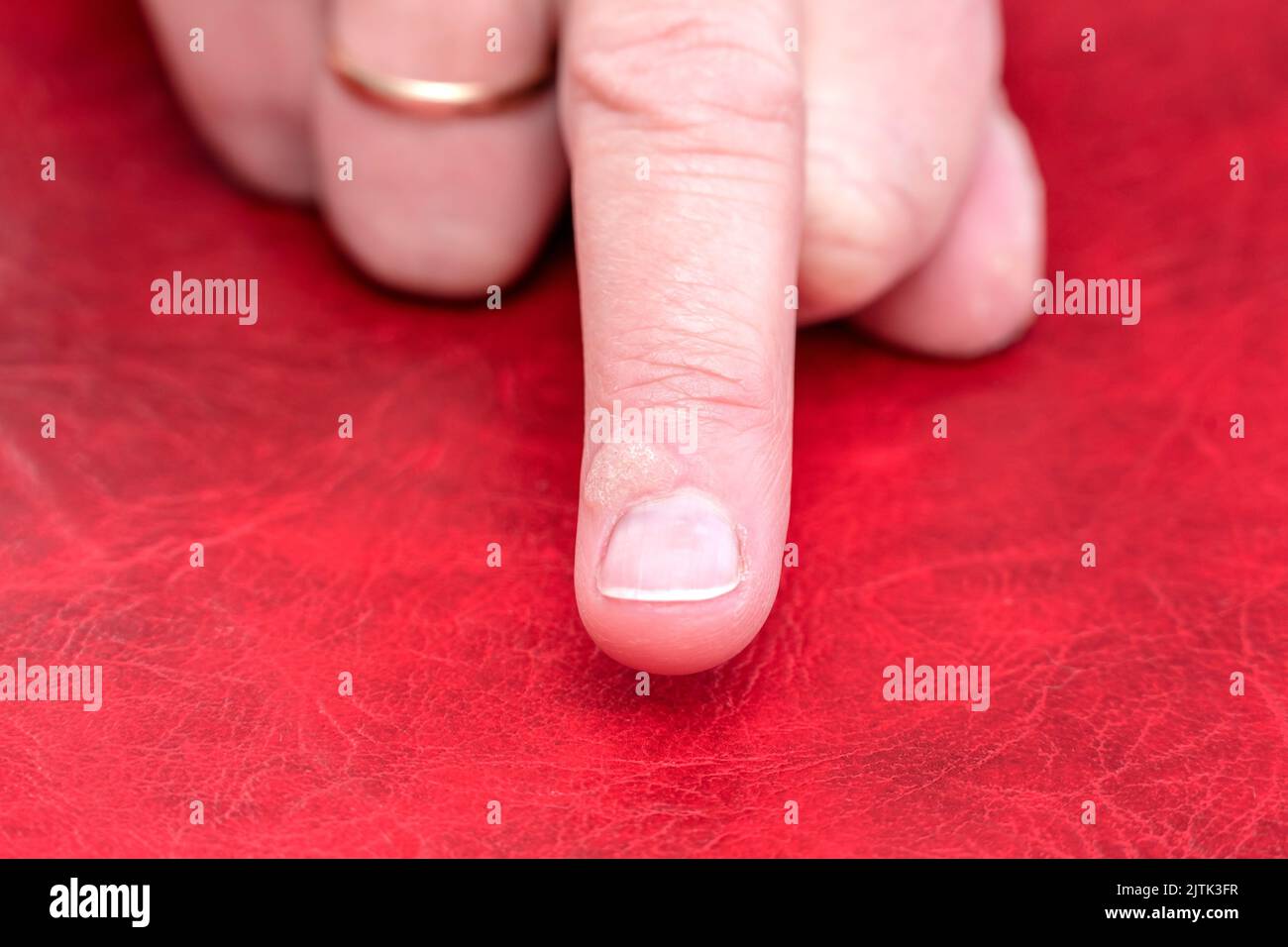 Tetrapods wart hi-res stock photography and images - Alamy