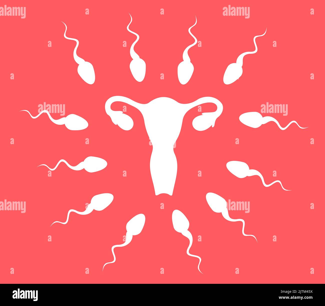 Multiple sperms are heading to fertile uterus and womb with ovaries ...