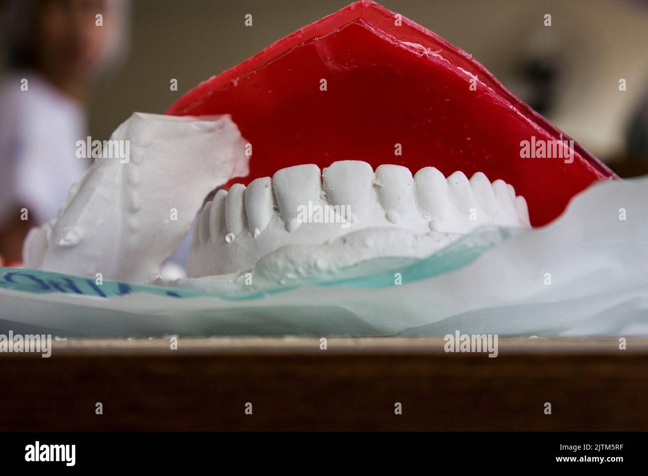 dental prosthesis mold on a table rio de janeiro Brazil Stock Photo - Alamy