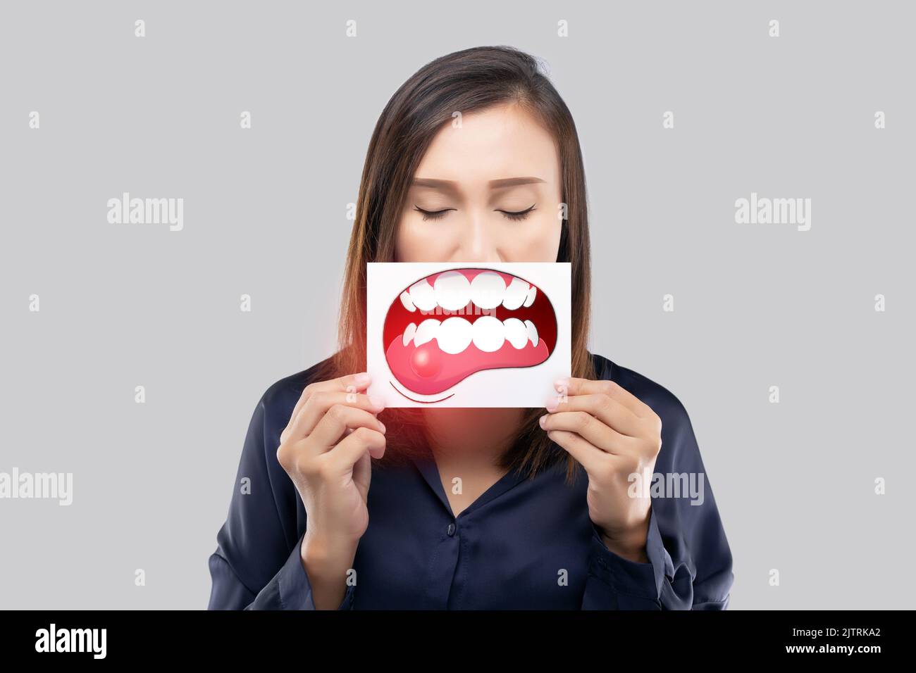 Periodontal disease, Gingivitis or inflammation of the gums Stock Photo ...