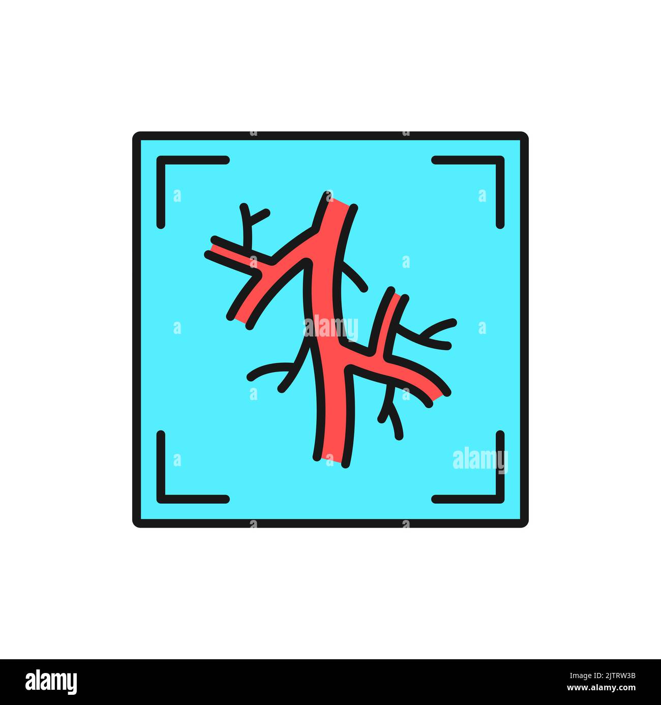 MRI diagnostics, tomography and CT radiology scan angiography of ...