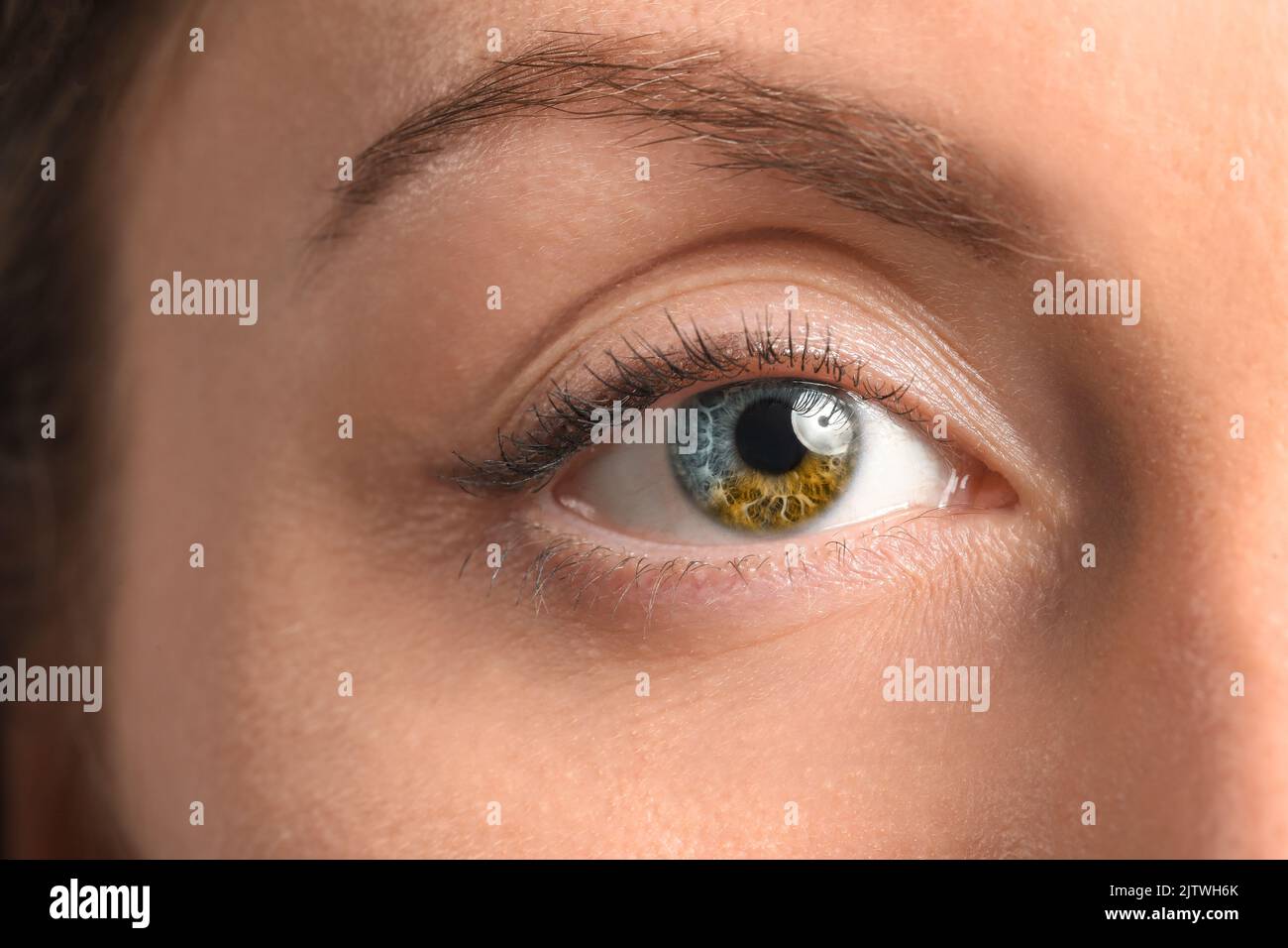 Young woman with heterochromia of eye, closeup Stock Photo - Alamy