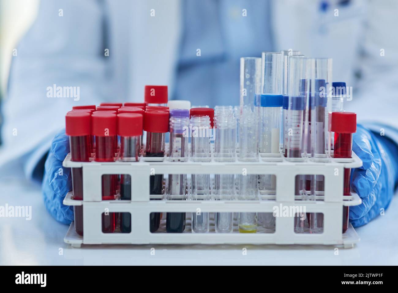Tubes for testing. Closeup shot of various test tubes lined in a tray ...