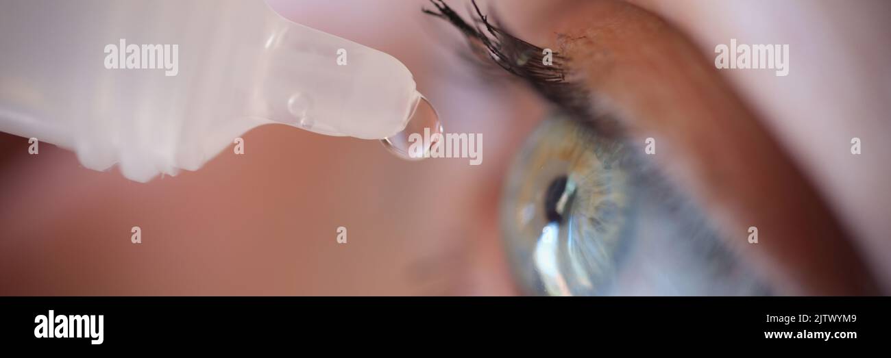 Woman dripping drops from plastic bottle into her eyes closeup Stock ...
