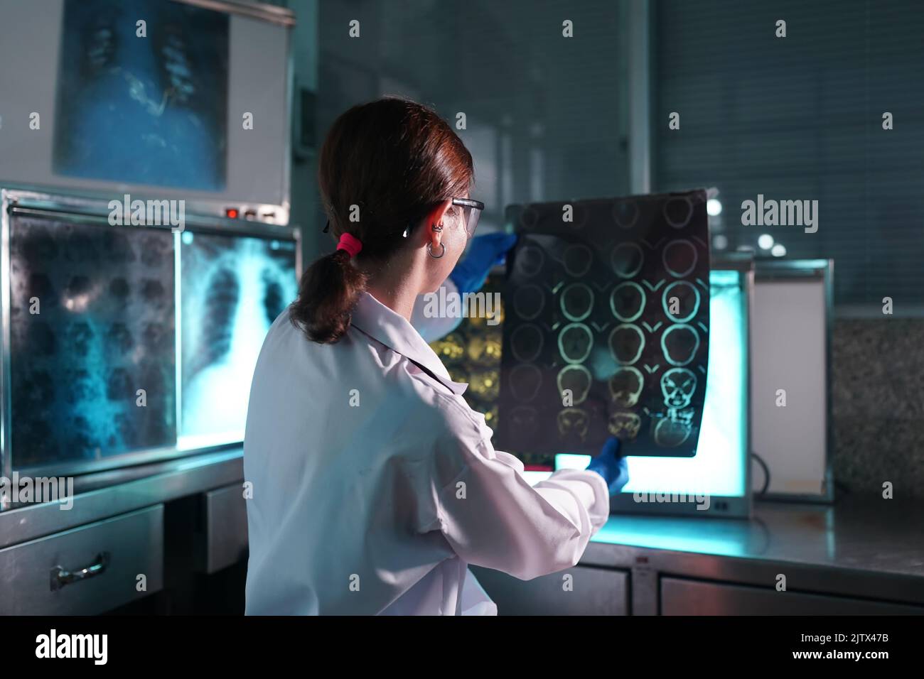 Team of doctors discuss results of X-Ray or MRI scan of patient's brain ...