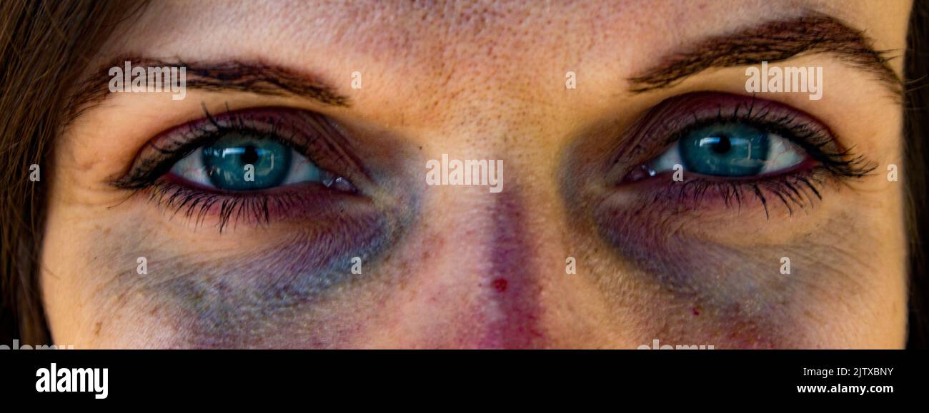 face of a woman who has suffered violence. Stop violence against women ...