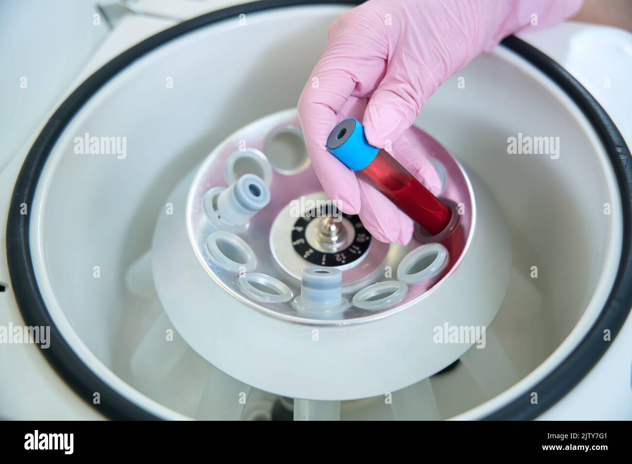 Preparation of blood for injections. Cosmetologist puts tube of blood ...