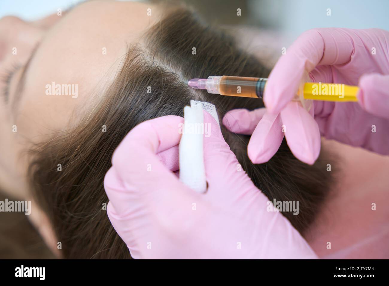 Cropped photo of head injection process for better hair growth Stock ...