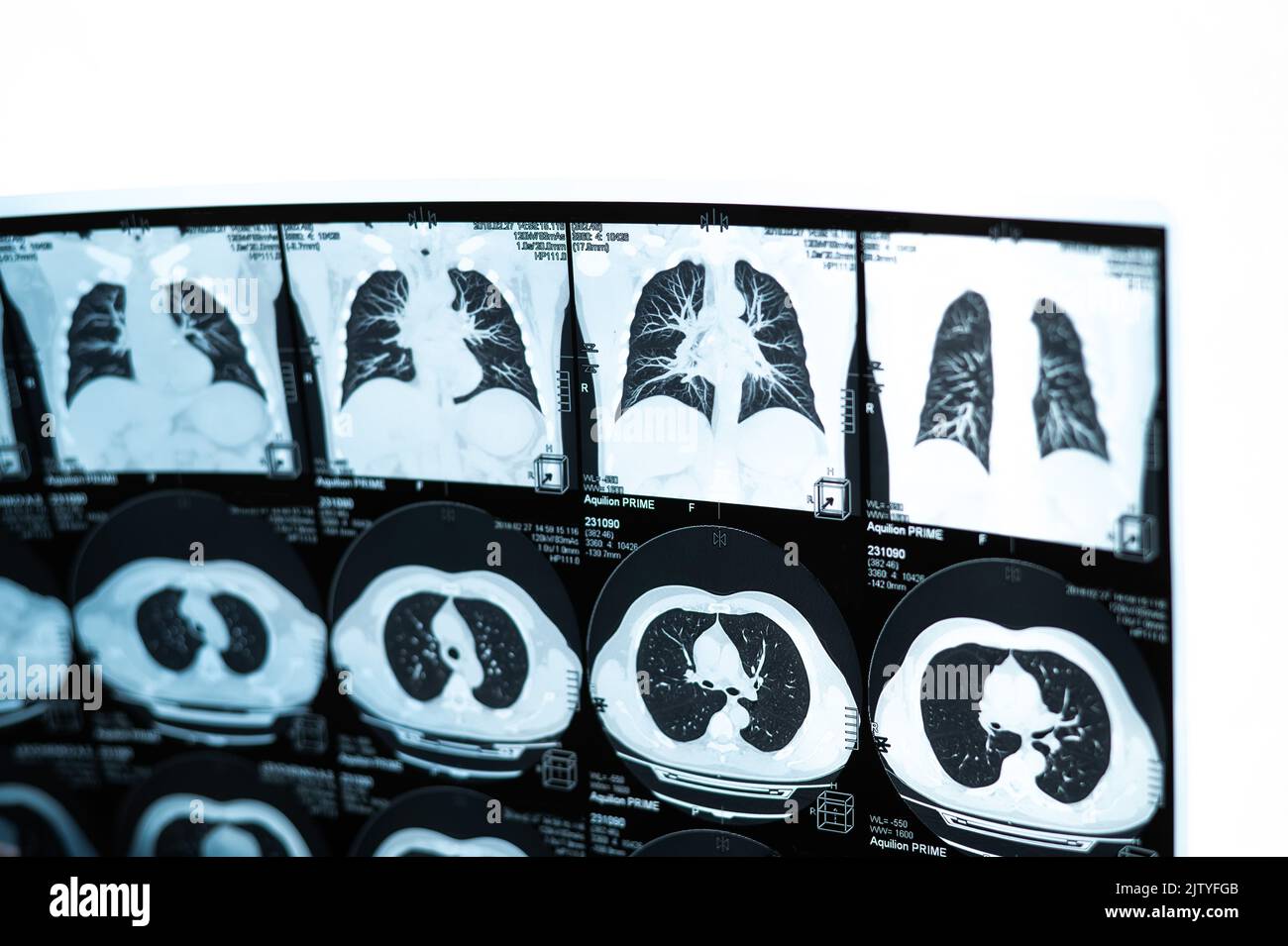 A female doctor examines an MRI scan of the internal organs. Abdomen ...