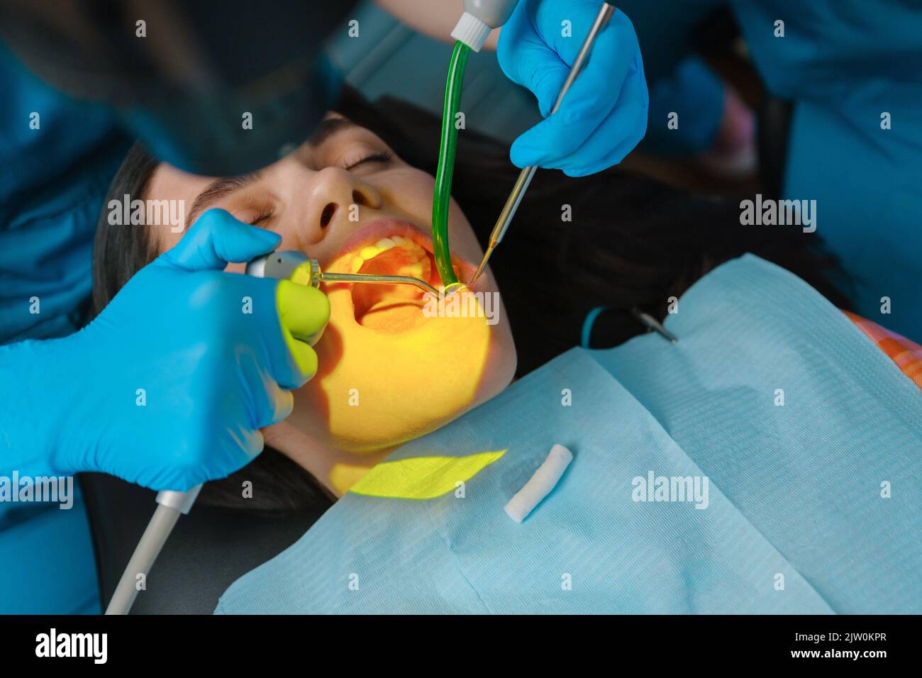Dentist uses photopolymer lamp to cure carious teeth of the female ...