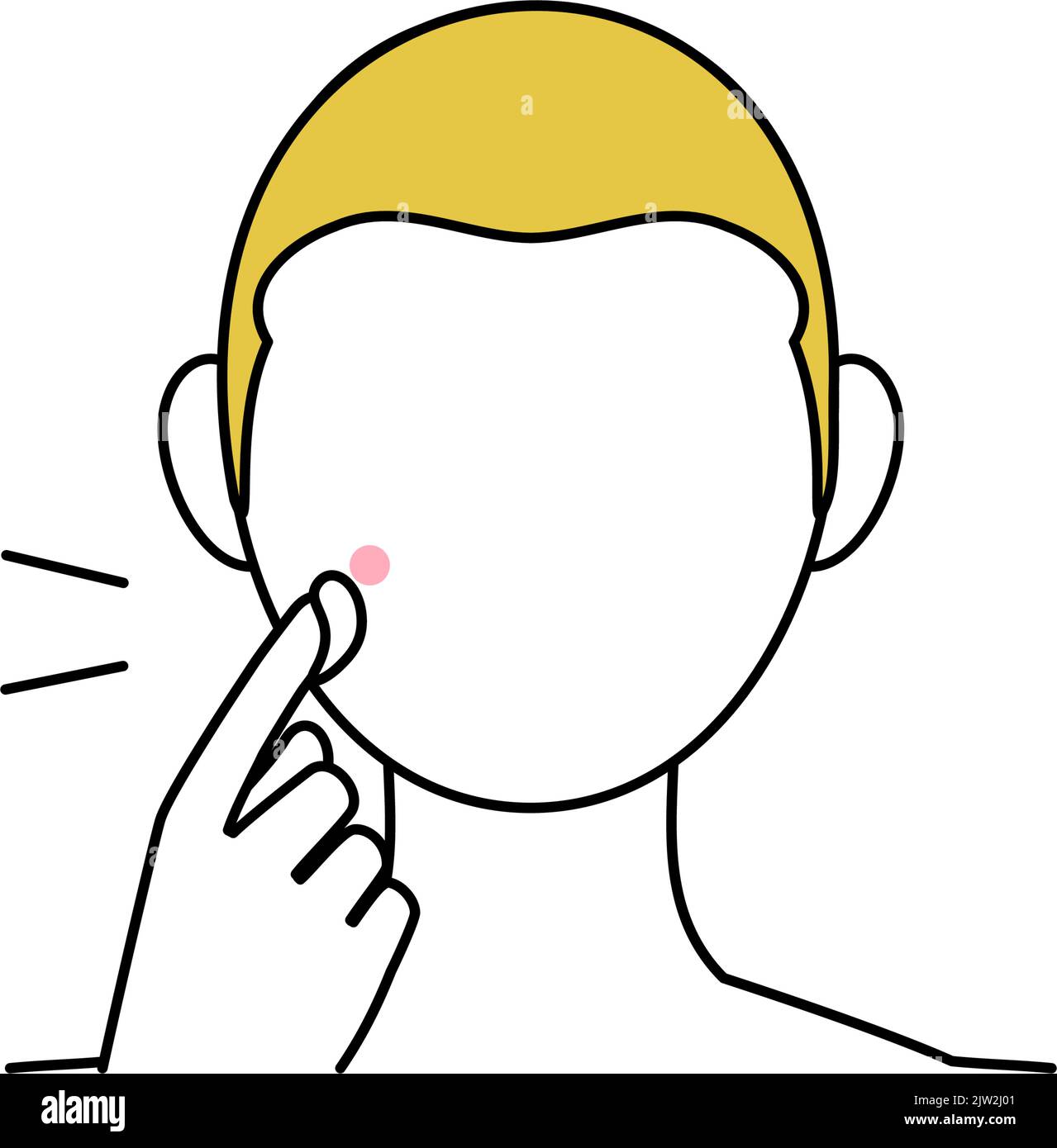 Acne drawing hi-res stock photography and images - Alamy