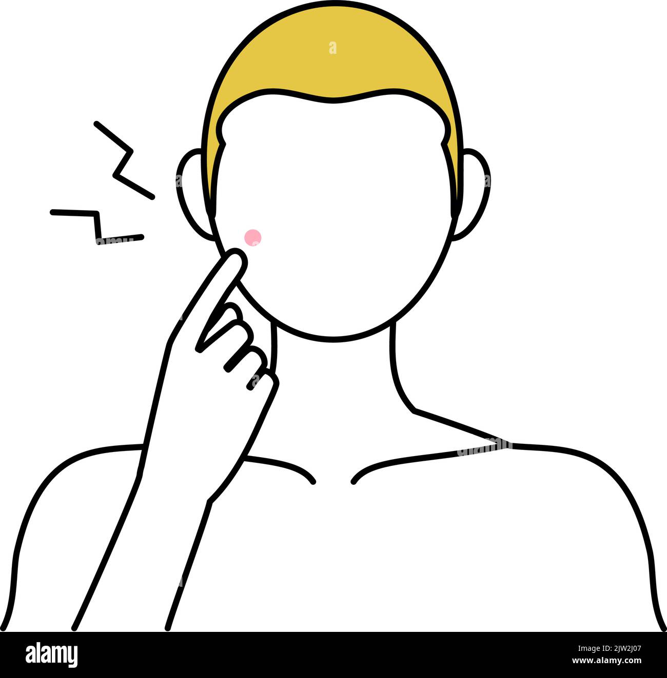Acne drawing hi-res stock photography and images - Alamy