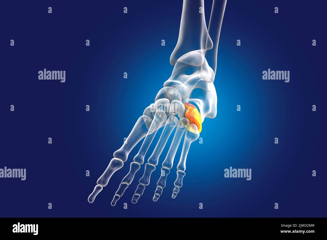 Cuboid bone of the foot, illustration Stock Photo - Alamy