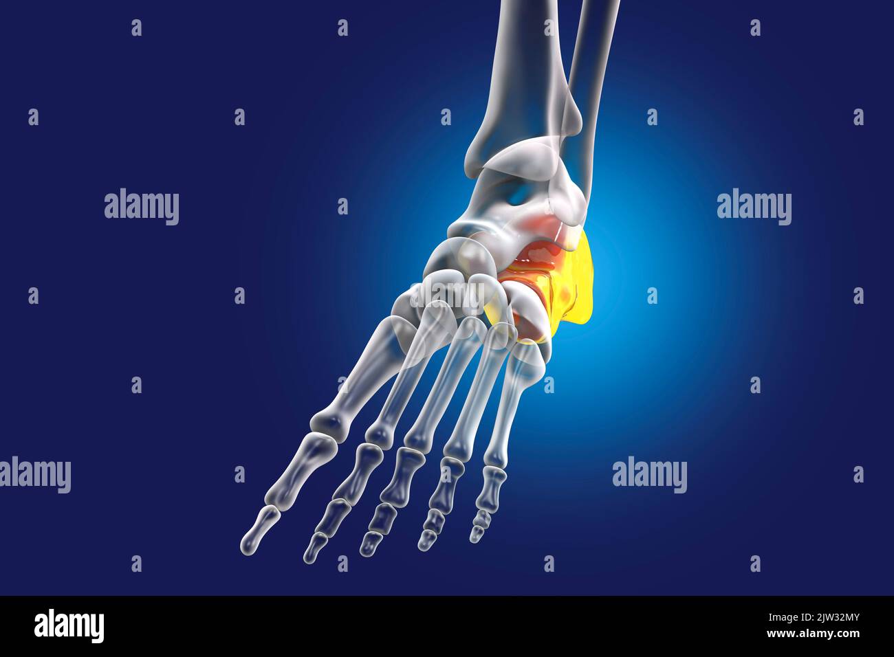 Illustration of the calcaneus, or heel, bone of the foot Stock Photo ...