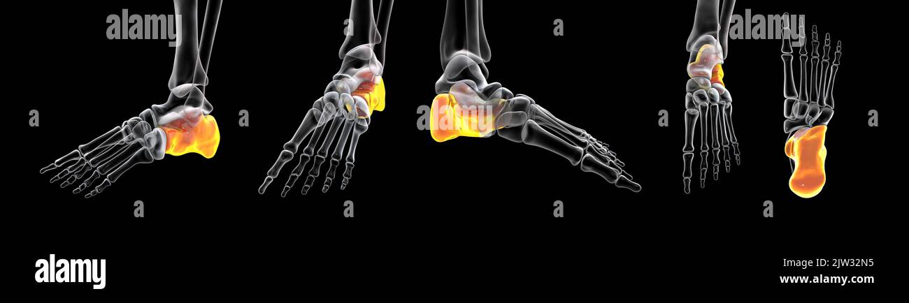 Illustration of the calcaneus, or heel, bone of the foot Stock Photo ...