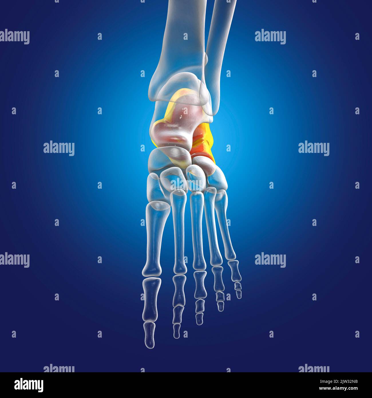 Illustration of the calcaneus, or heel, bone of the foot Stock Photo ...