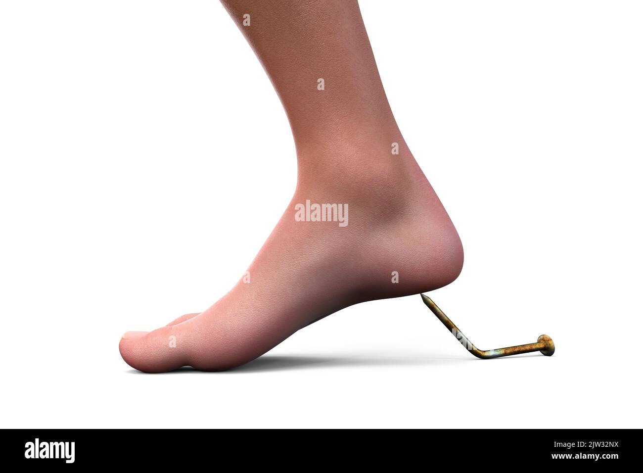 Infection transmission. Conceptual illustration showing an old rusty ...