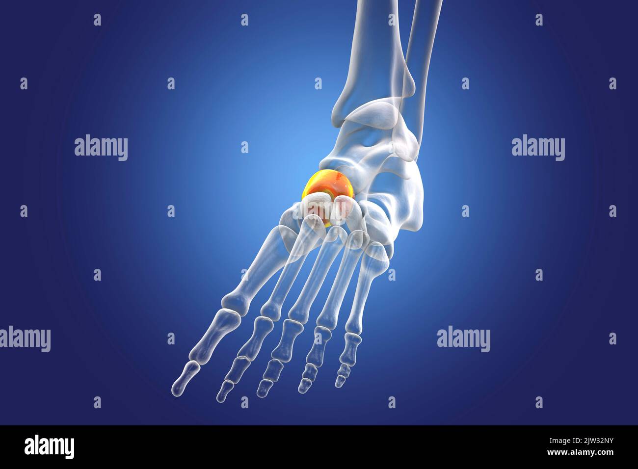 Navicular bone of the foot, illustration Stock Photo - Alamy