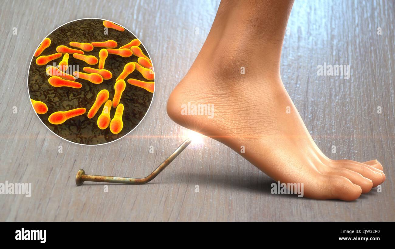 Infection transmission. Conceptual illustration showing an old rusty ...