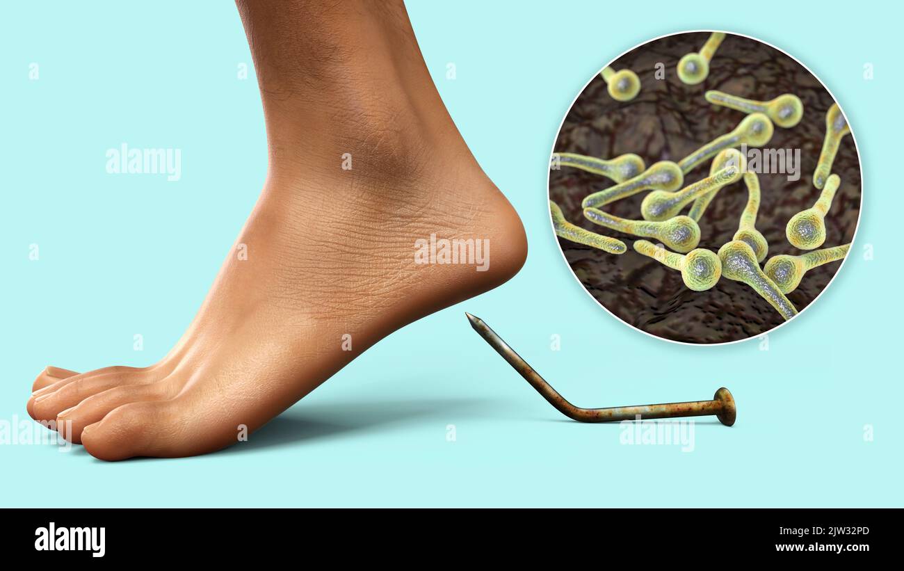 Infection transmission. Conceptual illustration showing an old rusty ...