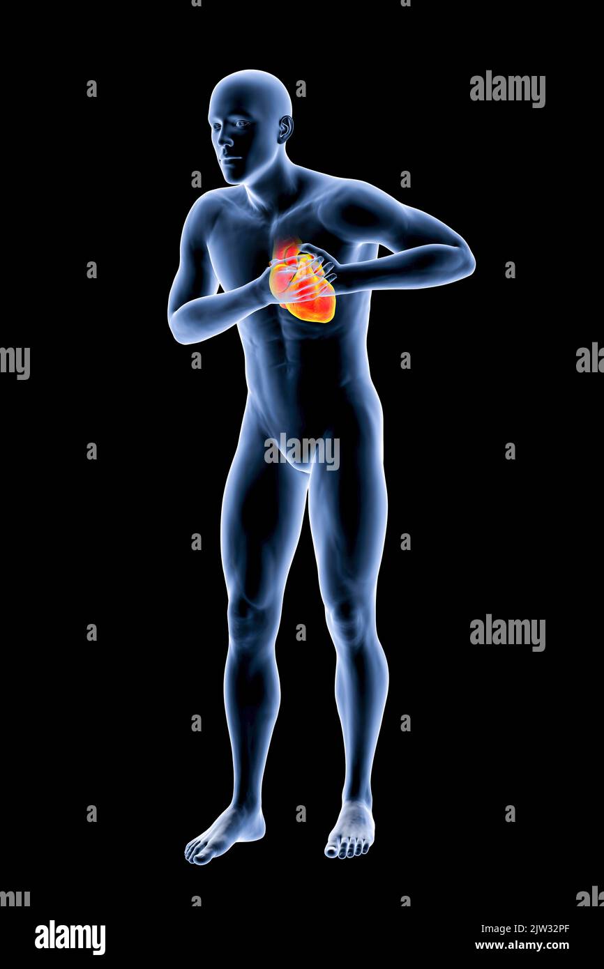 Man with chest pain, illustration Stock Photo - Alamy