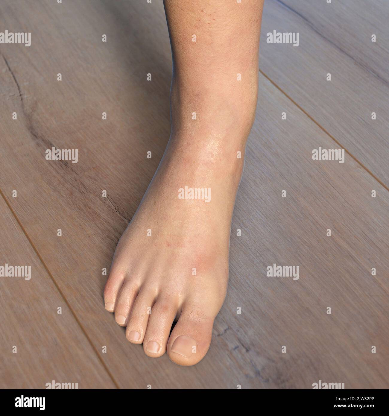 Cropped illustration hi-res stock photography and images - Alamy