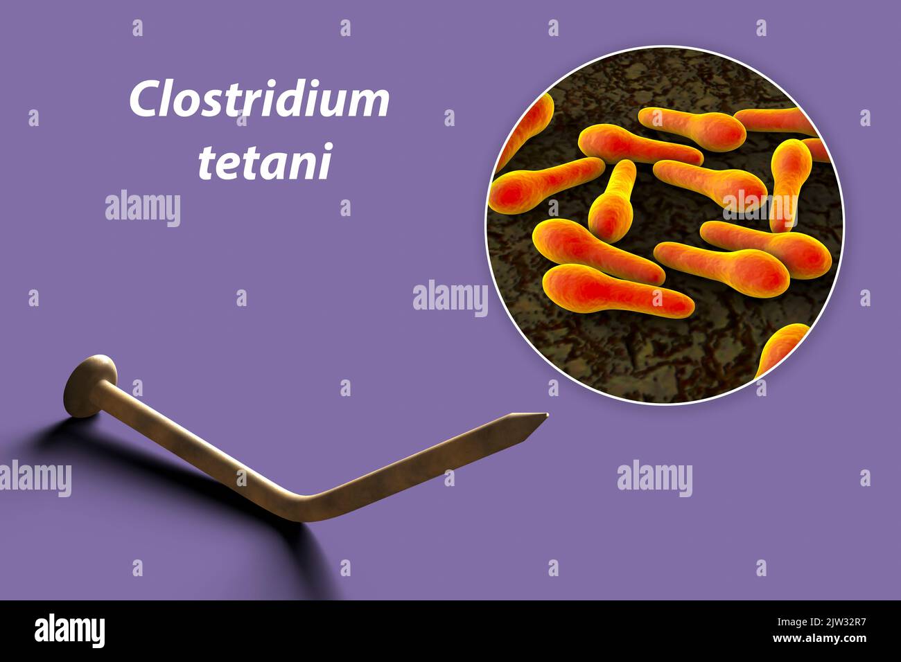 Transmission of tetanus bacteria. Conceptual illustration showing an ...