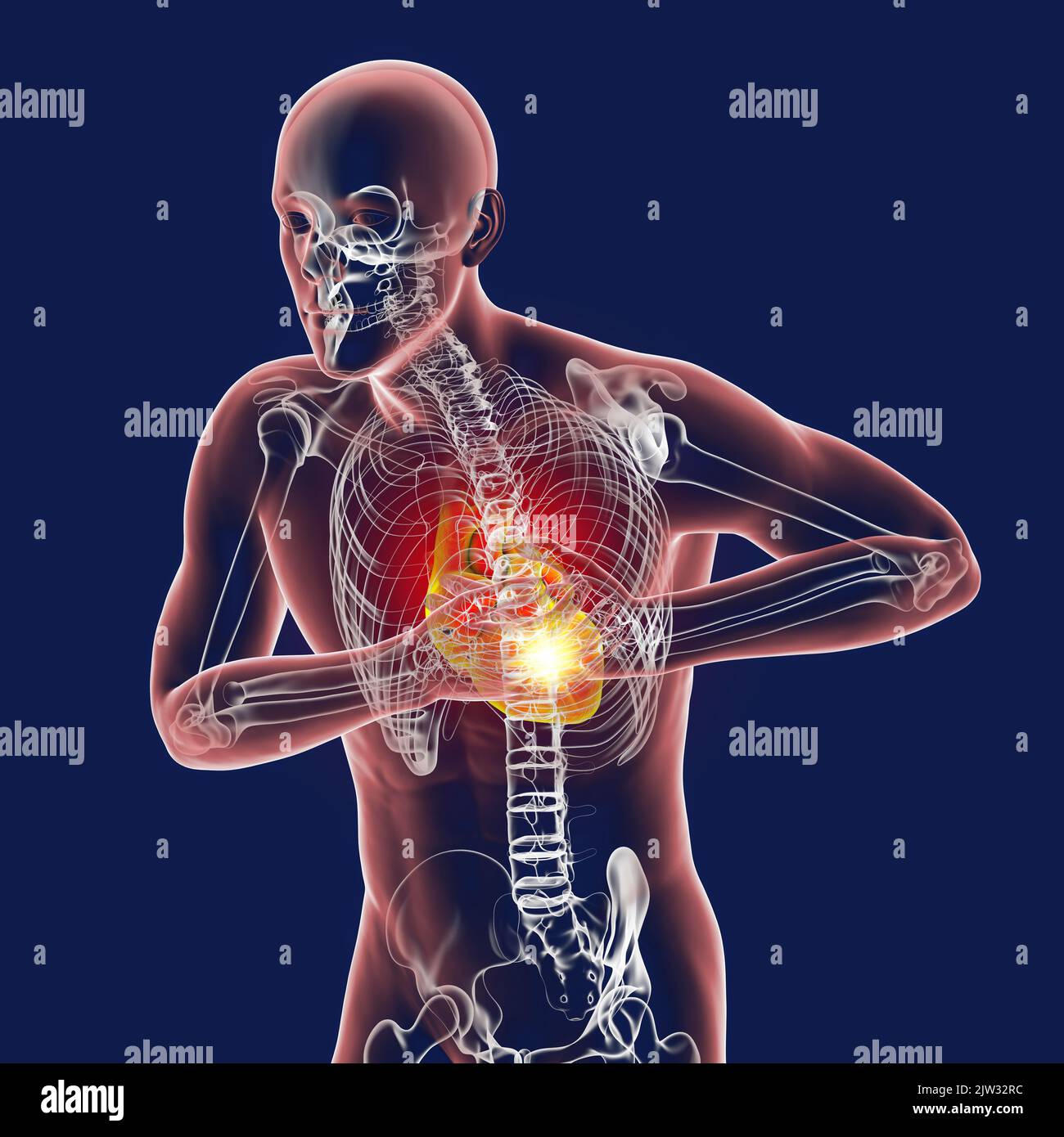 Man with chest pain, illustration Stock Photo - Alamy