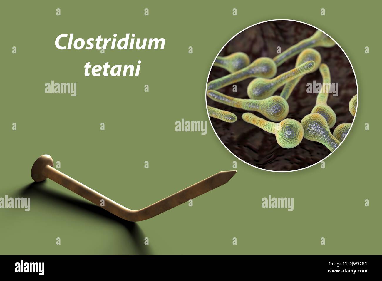 Tetanus Bacteria Labeled