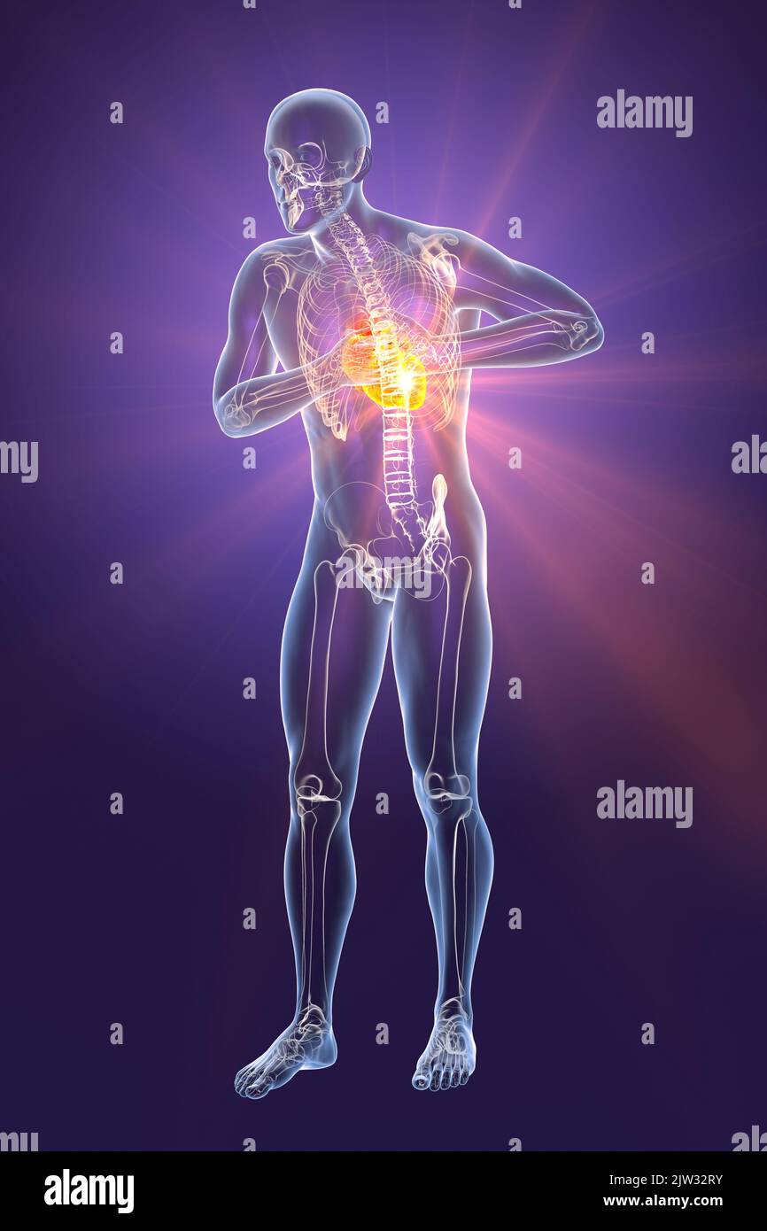 Man with chest pain, illustration Stock Photo - Alamy