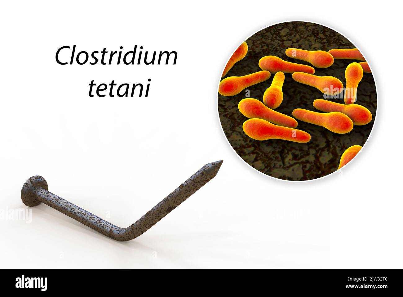 Cause of tetanus hi-res stock photography and images - Alamy