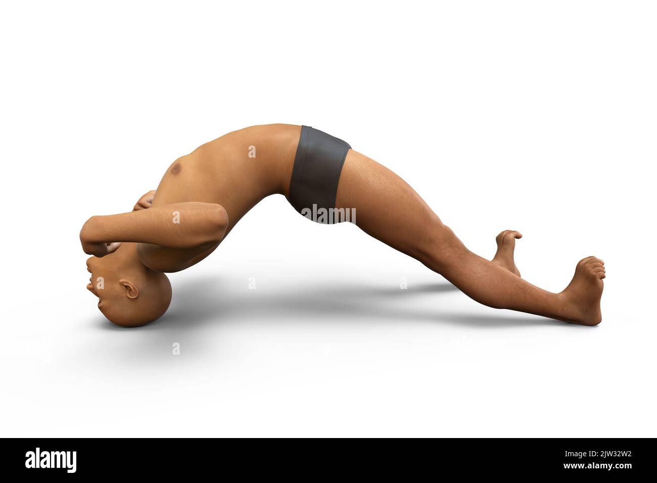 Illustration of opisthotonus (backward spasm) in a man with tetanus. Opisthotonus is a state of ...
