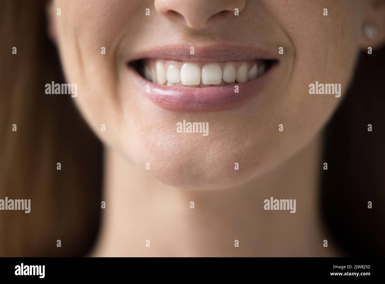 Mouth open wide woman closeup hi-res stock photography and images - Alamy
