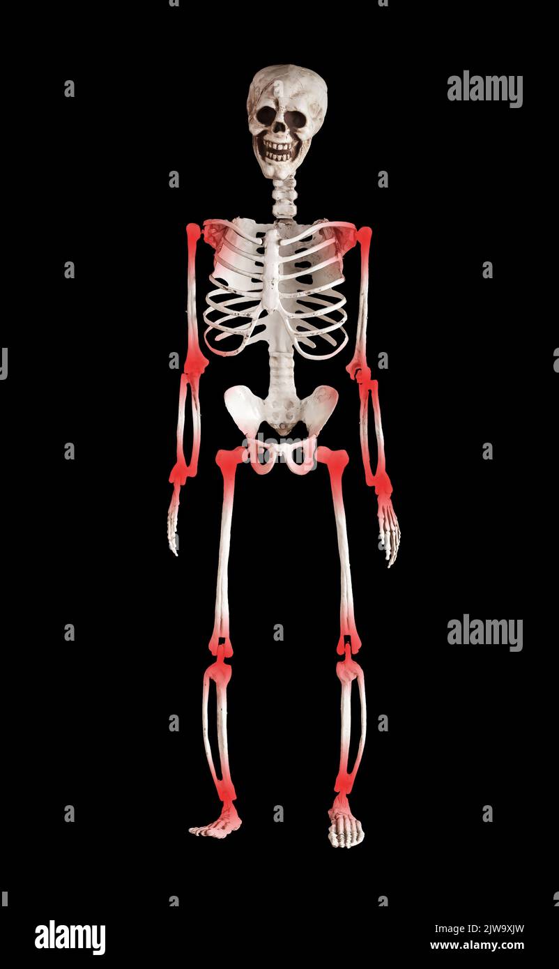 Joints and bones ache concept. Unhealthy skeleton. High quality photo Stock Photo - Alamy