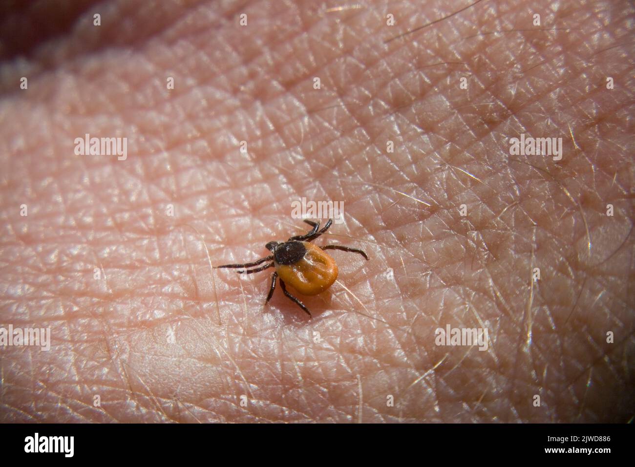 female castor bean tick about 3 Millimeter long, on human skin ...