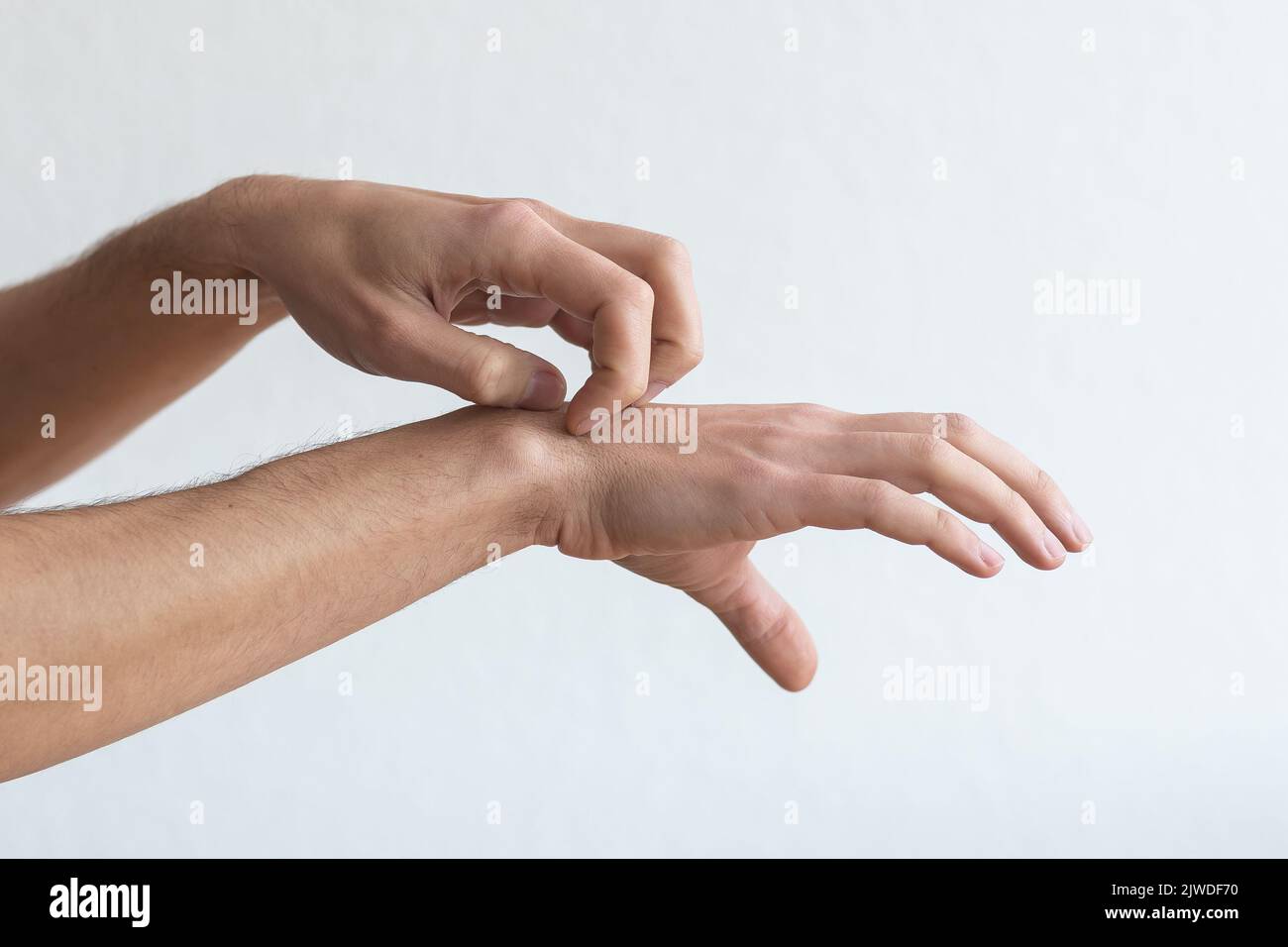 Dermatitis, eczema, allergy, psoriasis concept. man scratching itch on ...