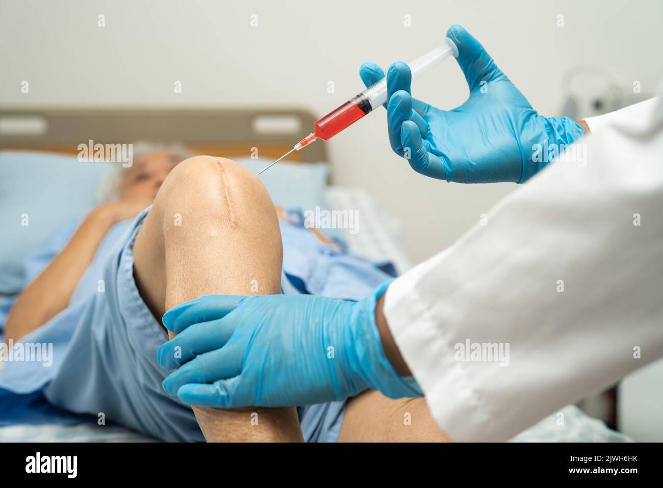 Asian doctor inject Hyaluronic acid platelet rich plasma into the knee of senior woman to walk ...