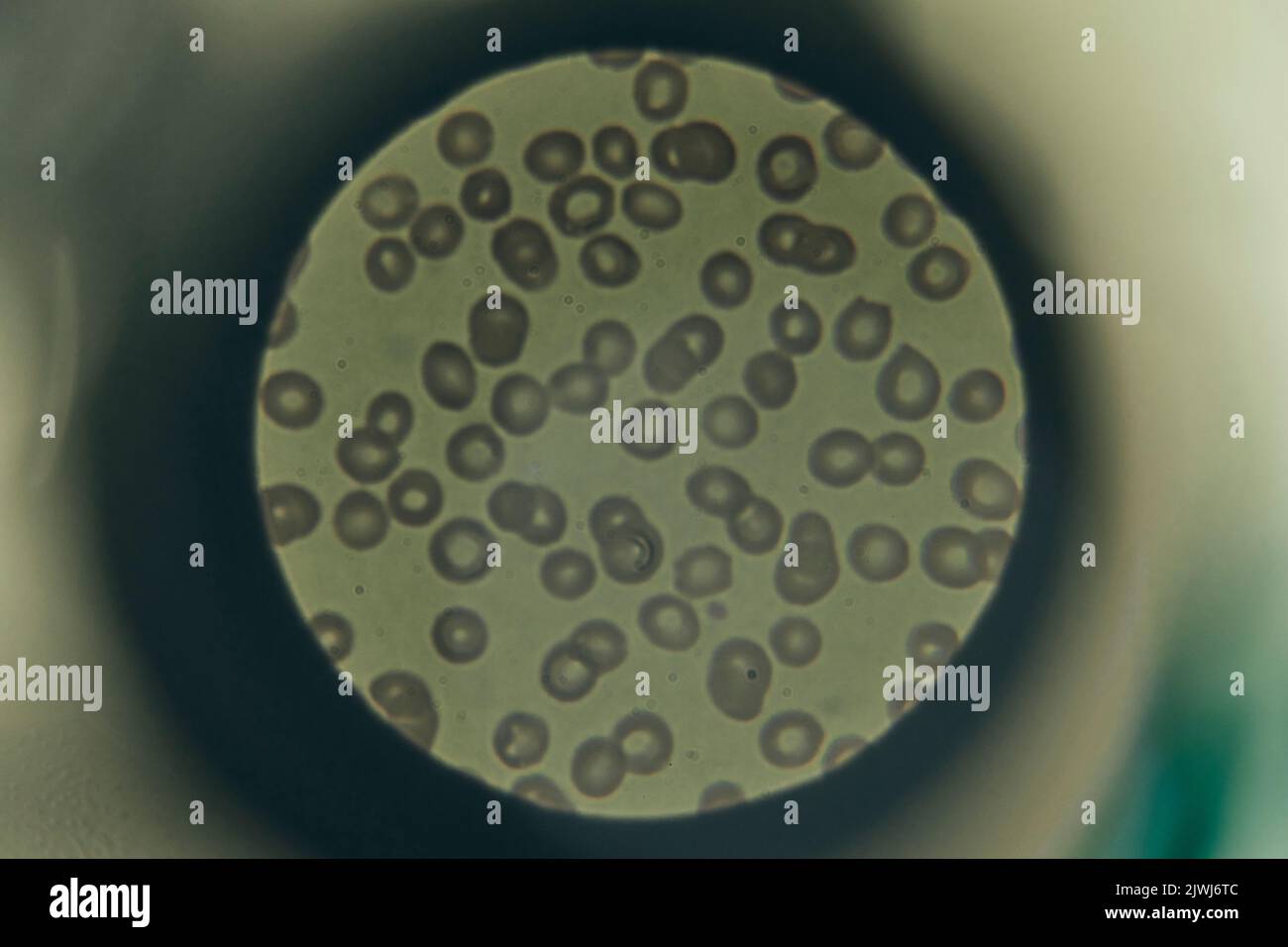 View from above blood sample under microscope Stock Photo - Alamy