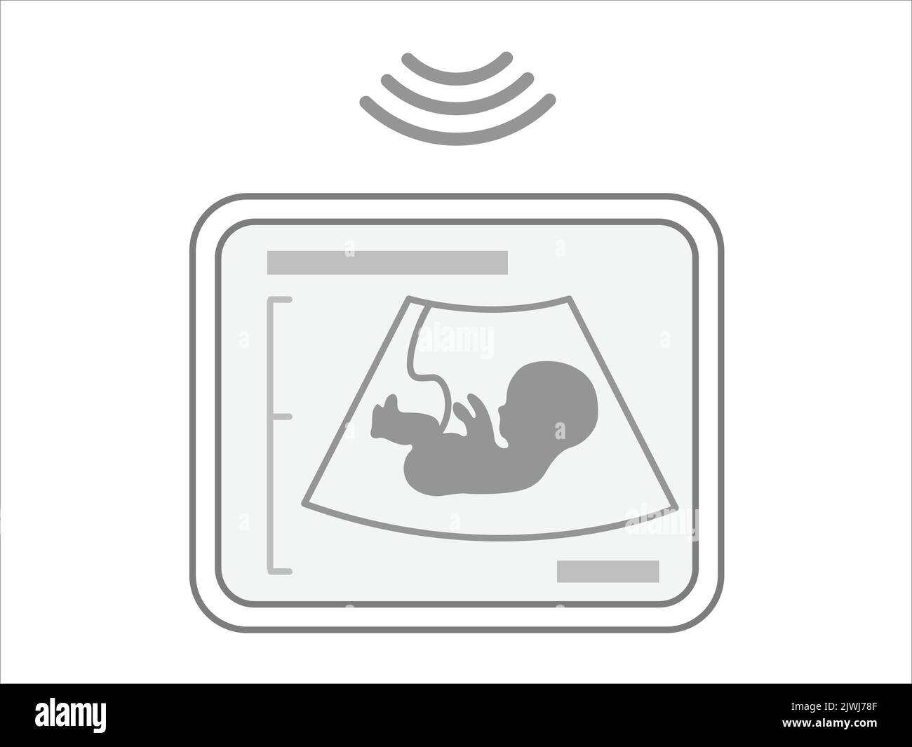 Embryo screening Black and White Stock Photos & Images - Alamy