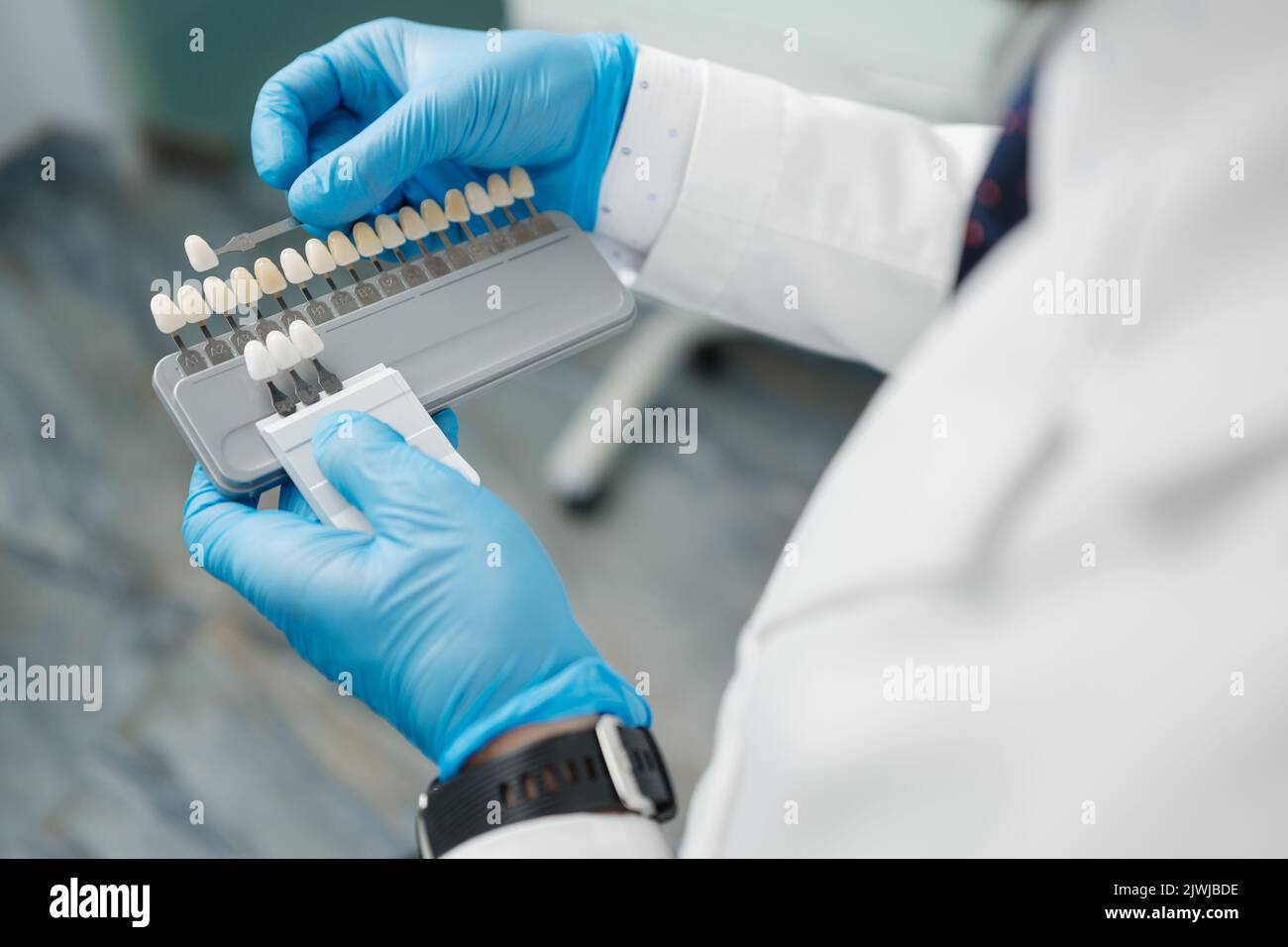 A closeup shot of the dentist selecting the color of the tooth enamel ...