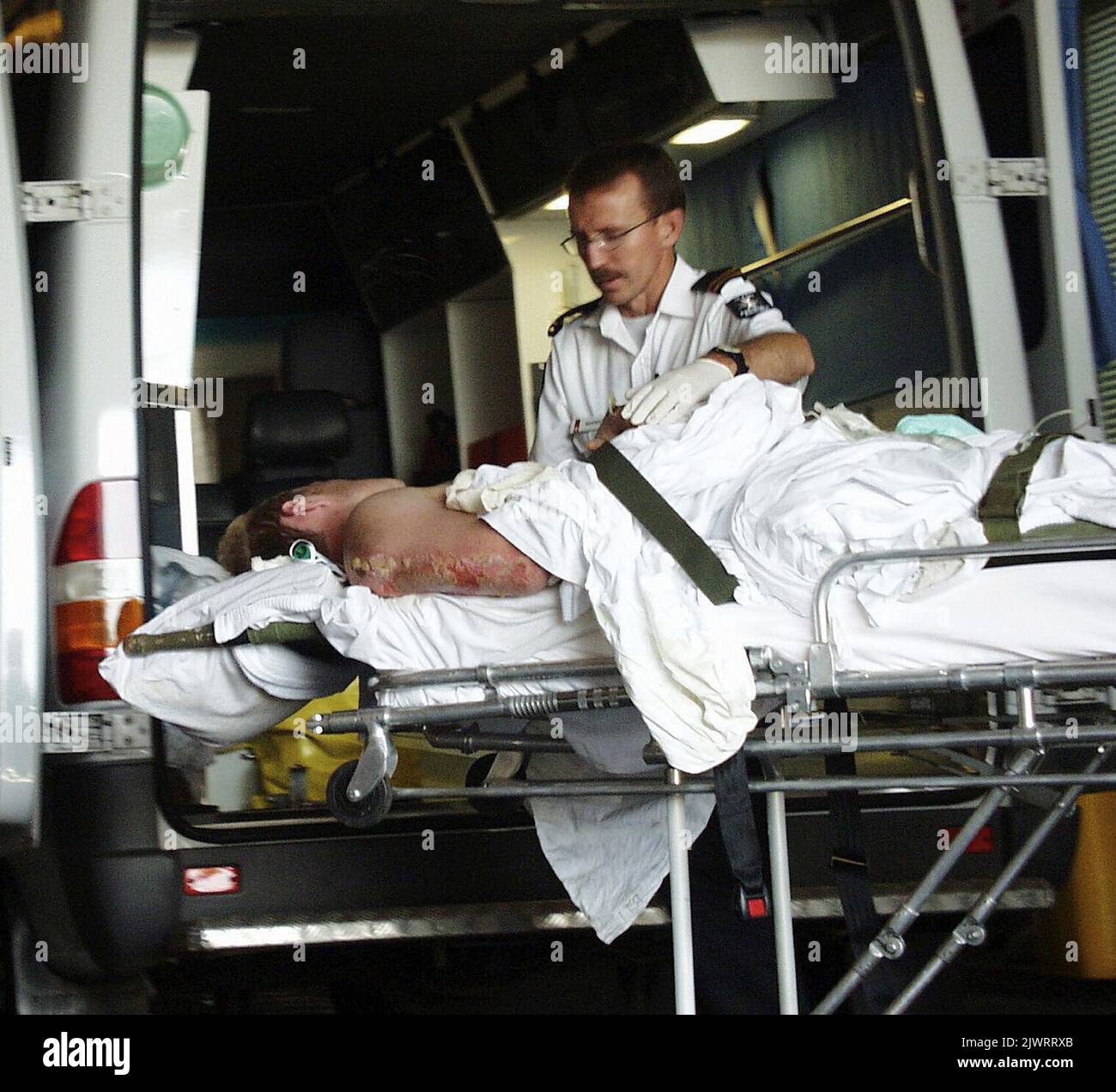 PA PHOTOS/AAP - UK USE ONLY: Burns victims arrive at the Royal Darwin ...