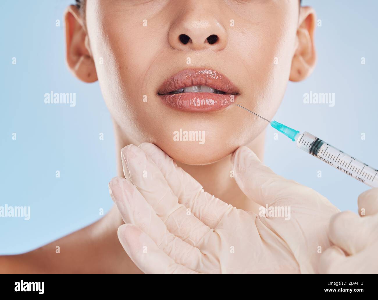 Plastic surgery, collagen and lip filler for facial beauty aesthetic ...